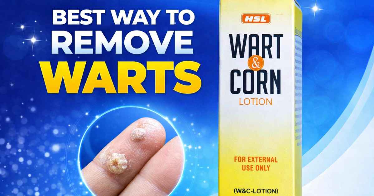 BEST WAY TO REMOVE WARTS – Complete Guide to Safe & Effective Wart ...